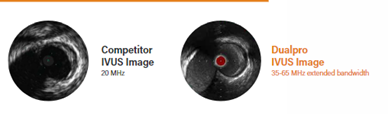 Dualpro™ IVUS+NIRS Catheter | Nipro