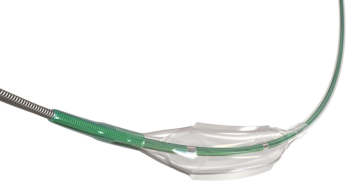 NSE ALPHA™ | NiproNSE ALPHA – vascular medical device