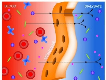 Hemodialysis Diffusion