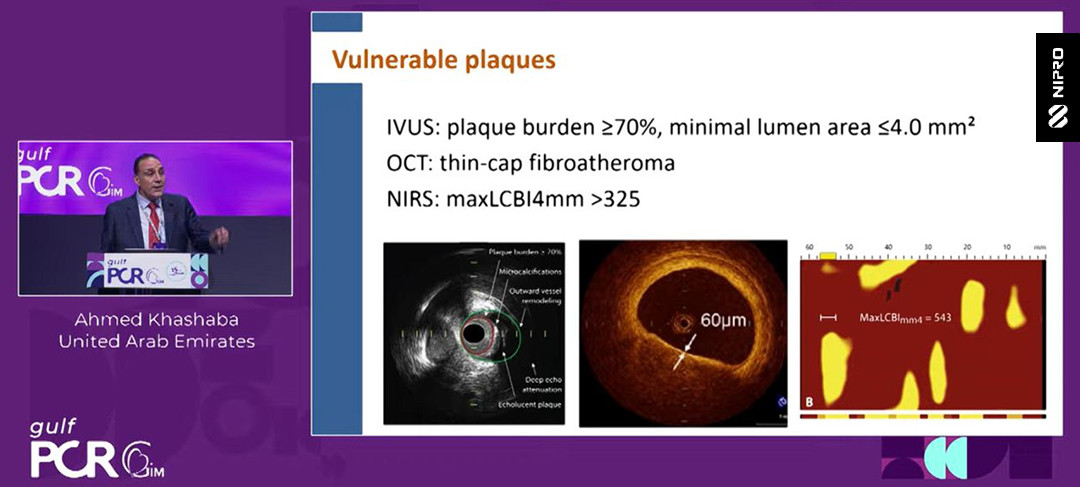 GulfPCR session: Precision PCI Starts with Better Insight - NIRS + IVUS